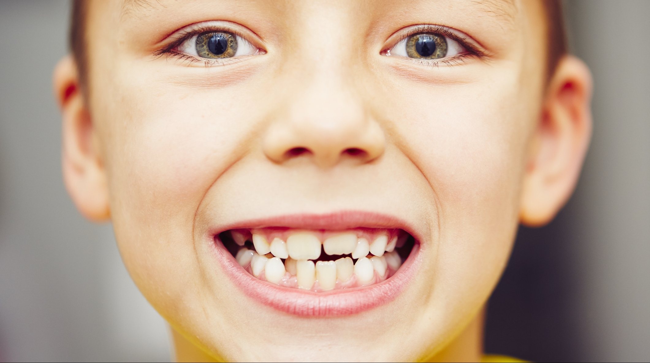 Ridges on the edge of teeth in children? - Dentist in Newbury Park